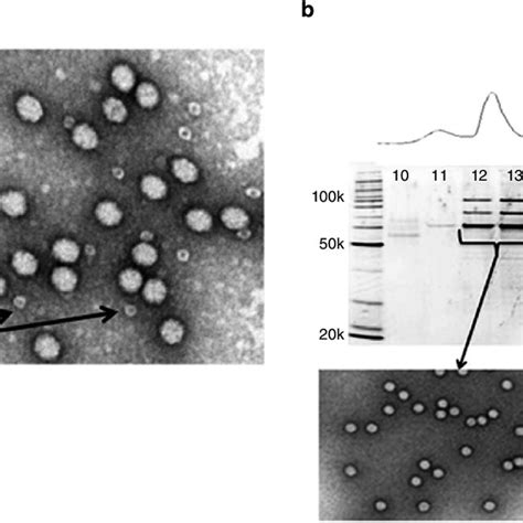 Depiction Of Recombinant Adeno Associated Virus Raav Manufacturing Download Scientific