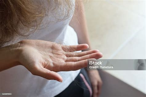 떨어진 머리카락을 잔뜩 들고 있는 여자 탈모 개념 또는 Trichotillomania 인간의 충동 행동 문제 머리카락 당김 장애 머리가 빠지다에 대한 스톡 사진 및 기타