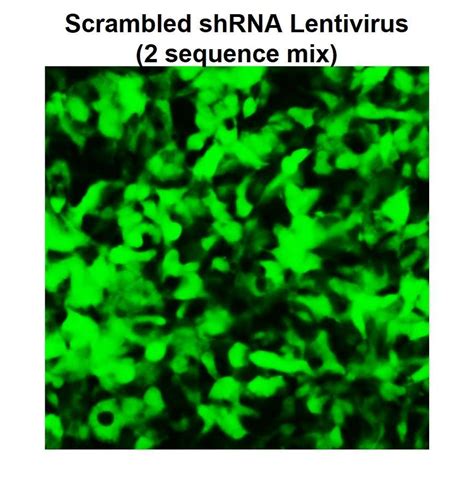 High Titer Scrambled Shrna Control Lentivirus — Lipexogen