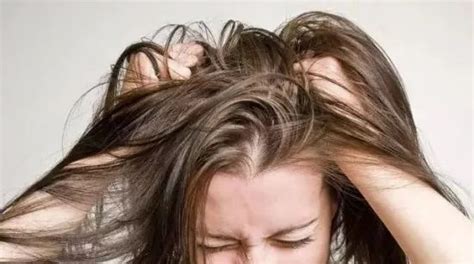头发经常油腻腻的怎么办？教你去除头发油腻的六个小妙招~