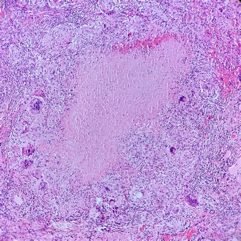 Pathology Outlines Histology