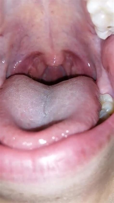Uvula Say Ahhh ThisVid Com Uvula Say Ahhh ThisVid Com
