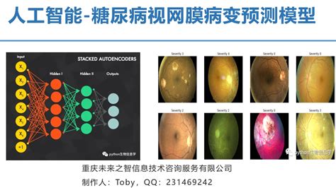 糖尿病视网膜病变预测模型 企业调研论文科研毕业设计机器学习 人工智能 哔哩哔哩