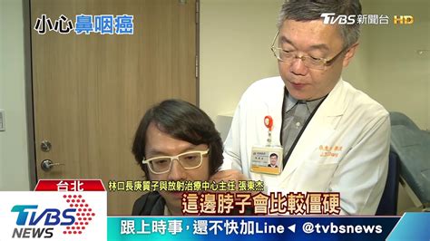 【十點不一樣】「鼻咽癌」初期症狀不明顯醫：很難發現！ Youtube