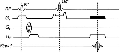 Pulse Sequence Diagram Of A Mars Modified Conventional Spin Echo Mr Download Scientific Diagram
