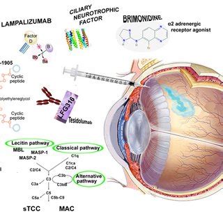 The Intravitreal Injection IVT Is A Procedure To Place A Medication Download Scientific