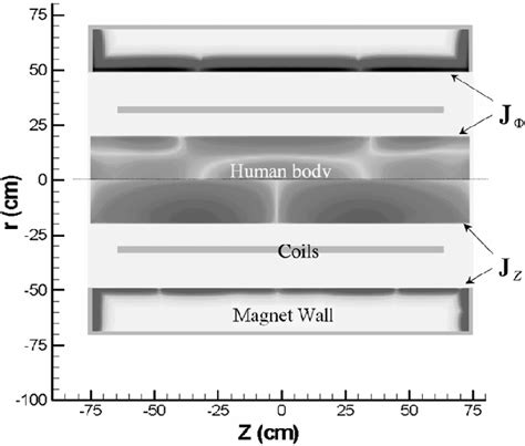 Figure 7 From An Fdtd Model For Calculation Of Gradient Induced Eddy