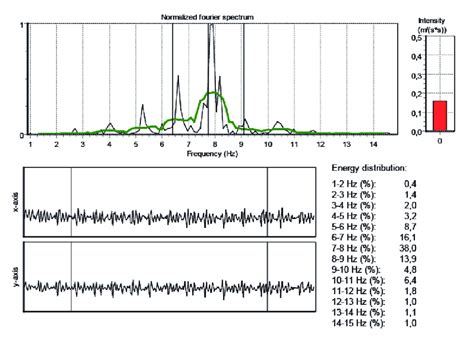 4 The Two Axis Perpendicular Accelerometric Tremor Recordings Over 82 Download Scientific