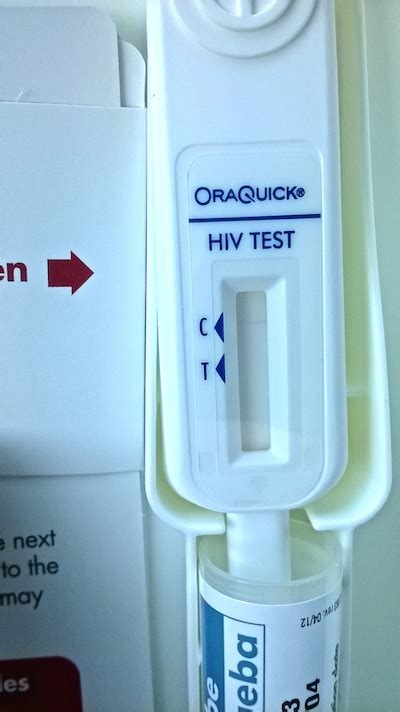 2 Negative Results From Oraquick