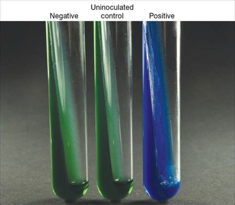 Citrate Utilization Test Flashcards Quizlet