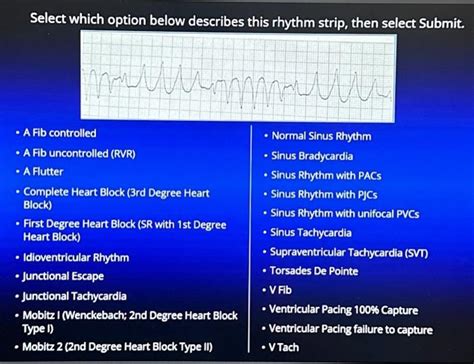 Solved Select Which Option Below Describes This Rhythm Chegg Com