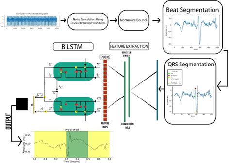 The Research Methodology Of Fetal Qrs Complex Classification Download