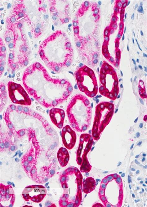 Automated Sequential Chromogenic Ihc Double Staining With Two Hrp Substrates Biorxiv
