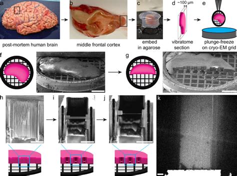 Ultrastructure Of Human Brain Tissue Vitrified From Autopsy Revealed By Cryo Et With Cryo Plasma
