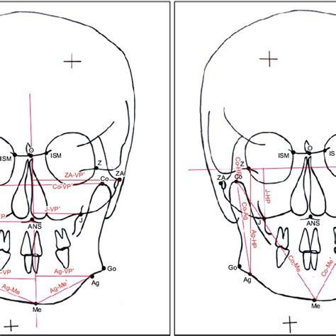 Bilateral Linear Parameters Refer To Table 1 For The Definition Of Download Scientific Diagram