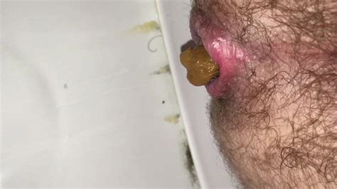 Hairy Ass Video 2 Gay Scat Porn At Thisvid Tube
