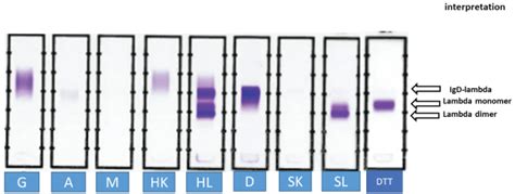 Immunofixation Serum Interpretation Mm