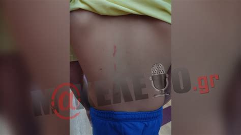 Η ΔΕΥΤΕΡΗ ΜΗΤΕΡΑ ΣΤΟ ΜΑΚΕΛΕΙΟ ΓΙΑ ΤΟ ΤΑΒΑΝΙ ΠΟΥ ΕΠΕΣΕ ΣΤΟ ΚΕΦΑΛΙ ΤΟΥ ΓΙΟΥ ΤΗΣ ΣΤΟ ΣΧΟΛΕΙΟ