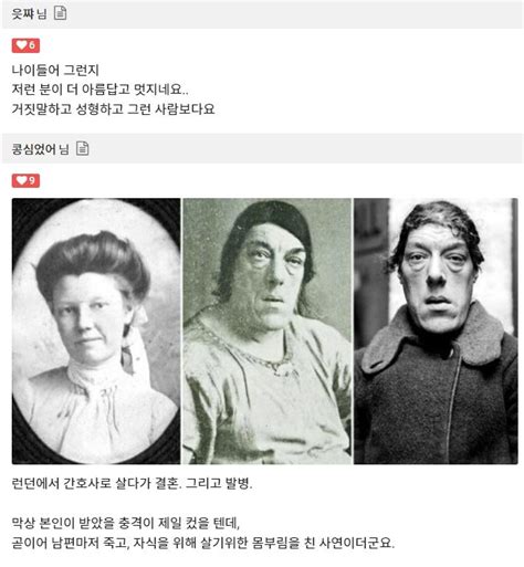 세상에서 가장 못생긴 여성 