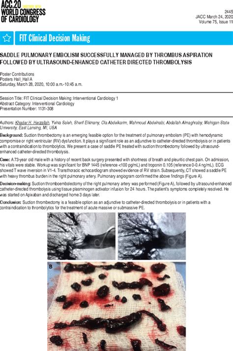 Saddle Pulmonary Embolism