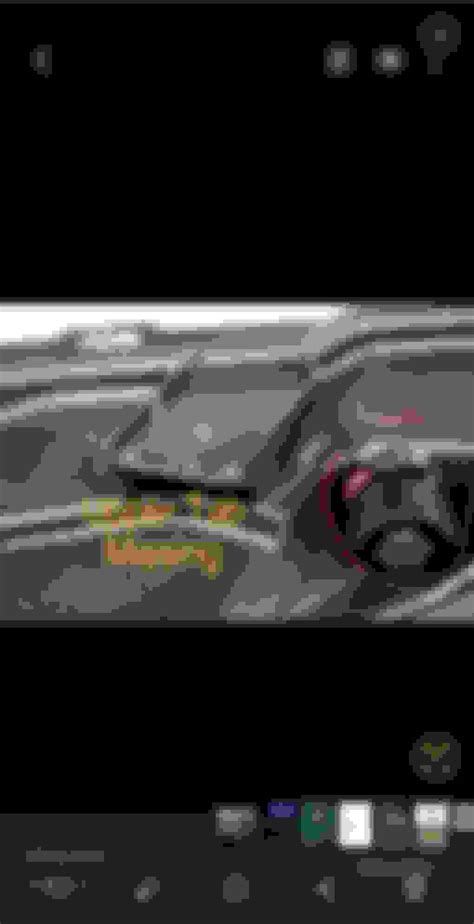 New Headlamp Assembly Will Not Adjust Ford F150 Forum Community Of Ford Truck Fans