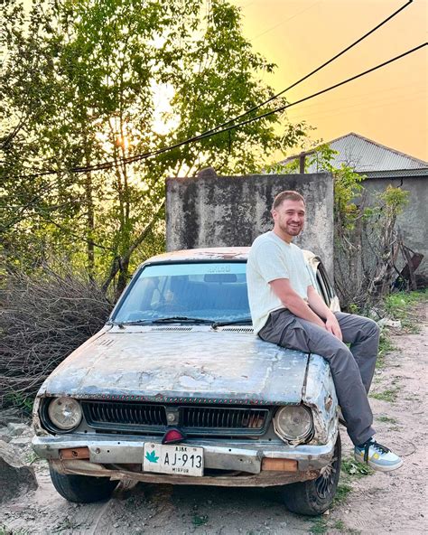 Muhammad Wasif Khan Day 1 Of My Hair Transplant Journey Started