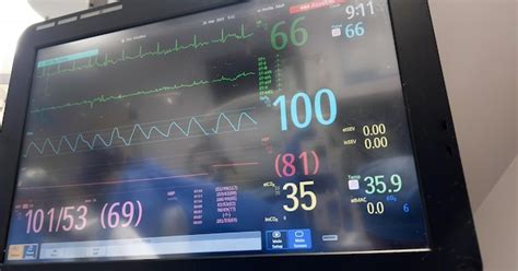 Premium Photo A Monitor With A Screen Showing A Heart Rate And A