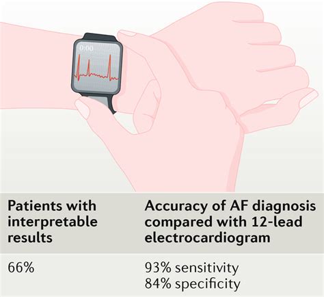 Detection Of Atrial Fibrillation Using A Smartwatch Pmc