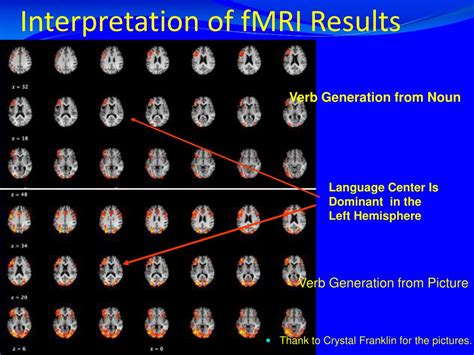Ppt Daily Fmri Practice Powerpoint Presentation Free Download Id3625546