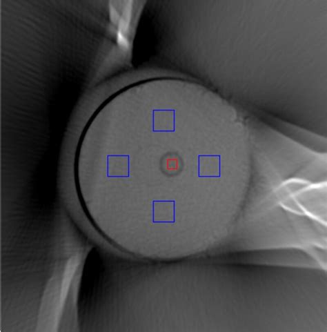 The Roi Selection Process For Truncation Evaluation Blue Squares For Download Scientific