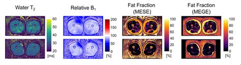 Table 1 From Fast Open Source Toolkit For Water T2 Mapping In The Presence Of Fat From Multi