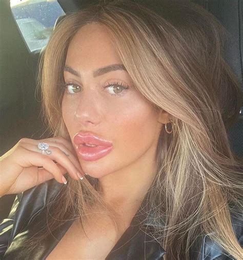 Her Lips Look Painfull Scrolller