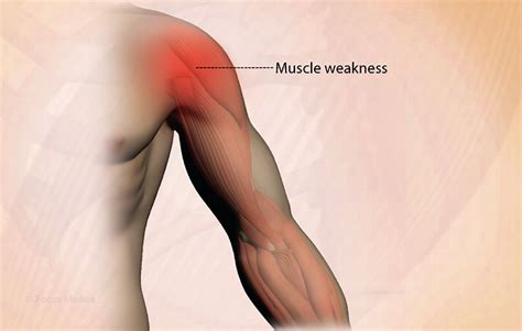 Health Condition Symptoms Causes Treatment And More