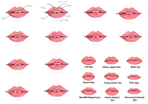 Fundamental Lip Filler Injection Techniques Digital Download