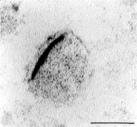 Figure 1 From The Role Of Matrix Vesicles In Growth Plate Development
