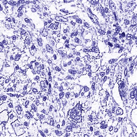 Decomposing Augmenting And Recombining Gives Purple Output · Issue 6648 · Scikit Imagescikit