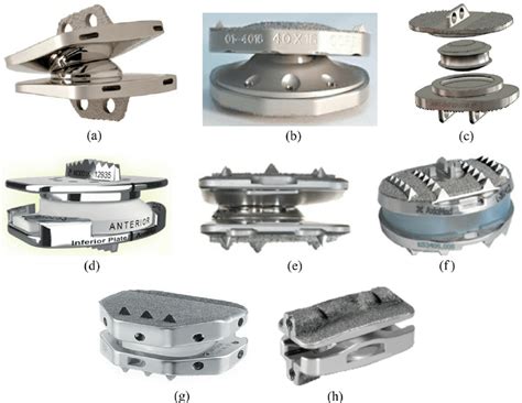 Disc Replacement Surgery London Uk Fusion Surgery London Uk