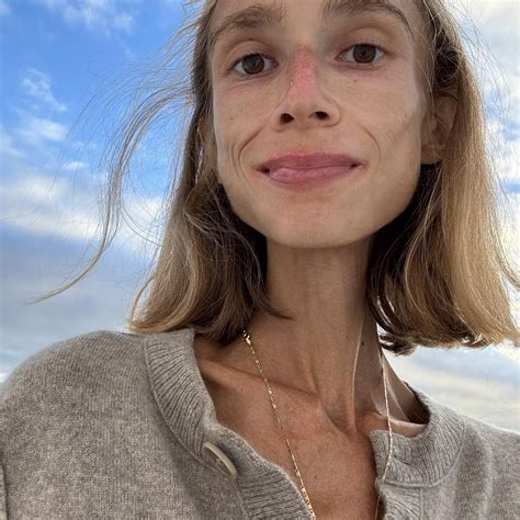 Karolina O Tânără De 27 De Ani A Murit După Ce A ținut O Dietă