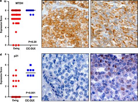 Differential Expression Of Myc Targets Mtdh And P21 In Cic Dux Sarcomas Download Scientific