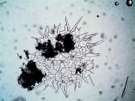 Fungi Microscope Photos Download The Best Free Fungi Microscope Stock