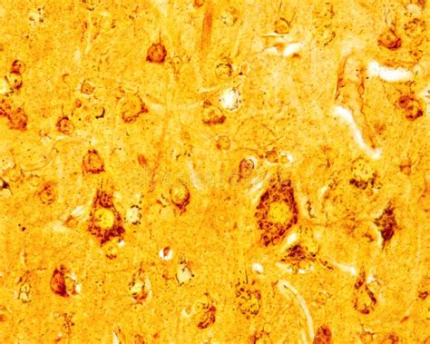 Cerebral Cortex Pyramidal Neurons Golgi Apparatus Stock Photo Image Of Golgi Cortex