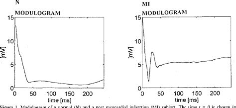Figure 1 From Detection And Frequency Characterization Of Ventricular Late Potentials Through