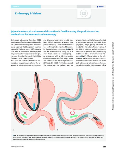 Pdf Jejunal Endoscopic Submucosal Dissection Is Feasible Using The