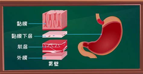 胃糜烂 是胃真的烂了吗 知乎