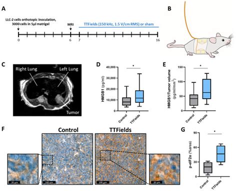 Tumor Treating Fields Ttfields Concomitant With Immune Checkpoint Inhibitors Are