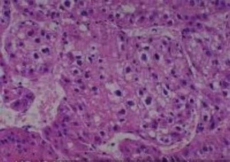 Novus Biologicals Human Multi Tissue Tissue Microarray Cancer Human