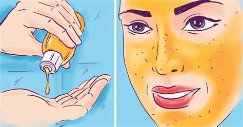 დაიწვეთეთ 5 წვეთი ხელებზე და დაიმუშავეთ სახის კანი რათა ნაოჭები და ლაქები 15 დღეში მოიშოროთ