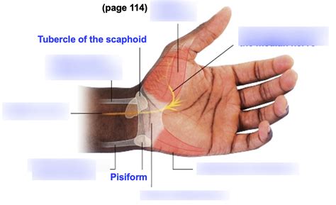 Diagram Of Orientation Of Median Nerve In CT Palmar View Wk Quizlet