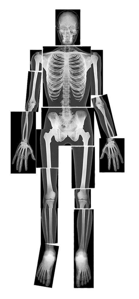 X Ray Clipart Png X Ray Png Images Cleanpng