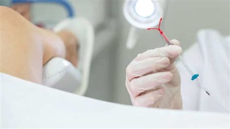 IUD Removal What You Need To Know Hormone University